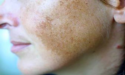 Cosmos Clinic - Leaders in Liposuction - Sydney, Gold Coast, Canberra ...